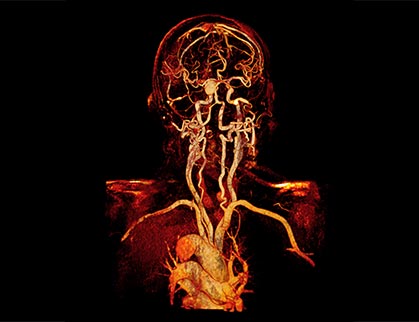 Facilitating PBL in Your Anatomy Classroom | BodyViz