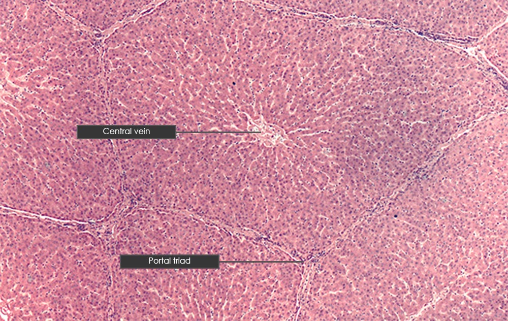 Living Patient Transplant | From Bones to Brains with Bob