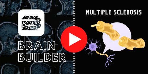 The Brain and Multiple Sclerosis | Real 3D Anatomy