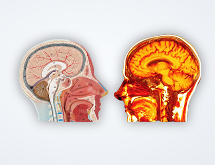 Modeled Anatomy Software vs Real Anatomy Software | BodyViz