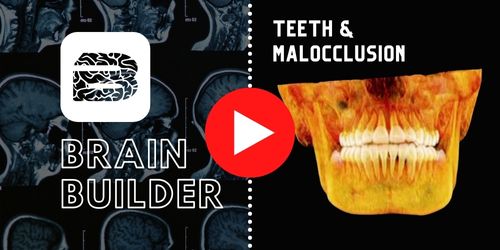 Teeth and Malocclusion | Brain Builder